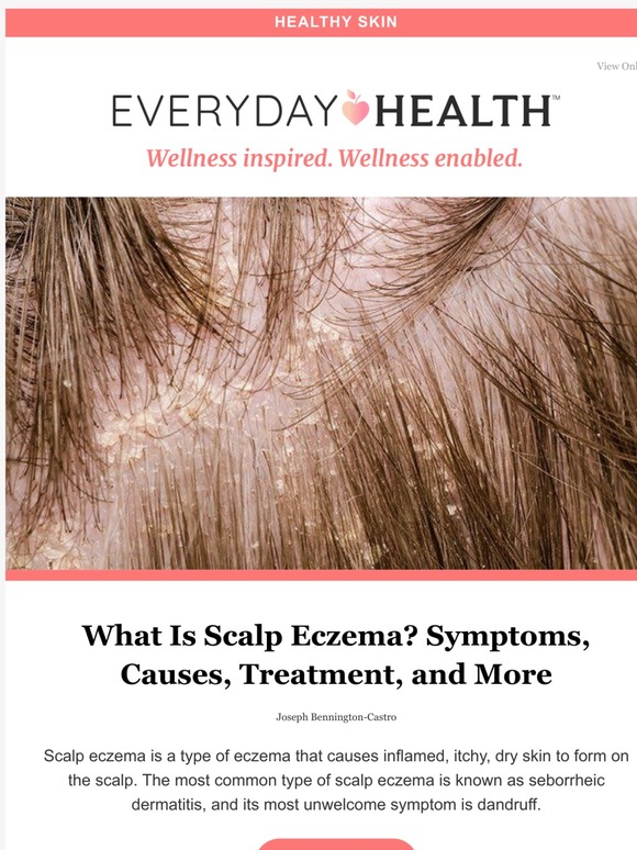 Lifescript What Is Scalp Eczema Symptoms Causes Treatment And More Milled