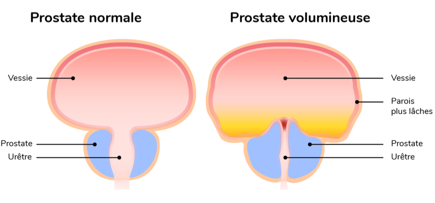 Cellinnov FR: 5 signes qui montrent que votre prostate va mieux | Milled