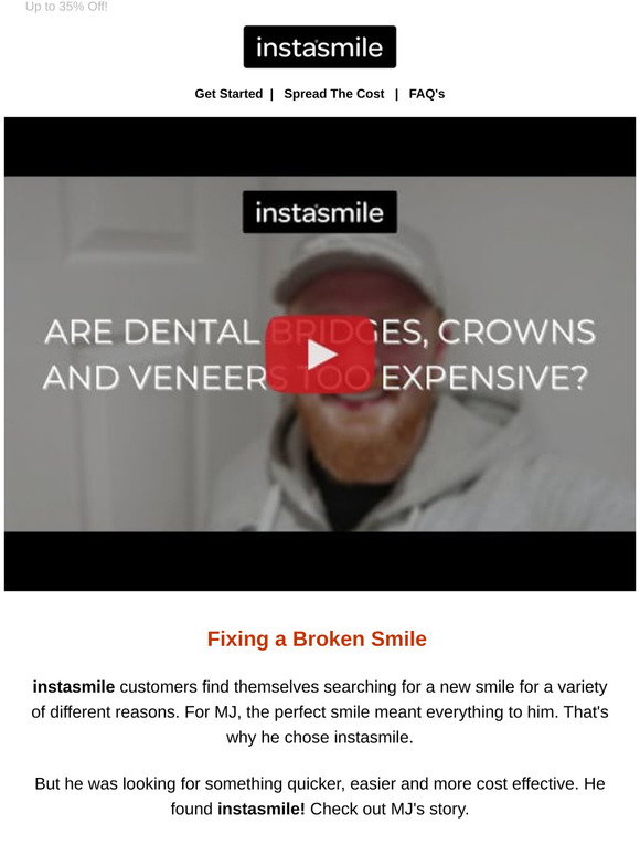 INSTAsmile: How MJ Transformed His Smile - Save up to £332 | Milled