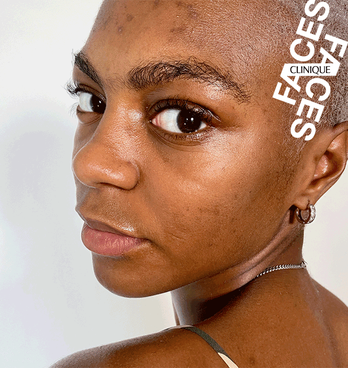 Clinique: How to help hyperpigmentation. | Milled