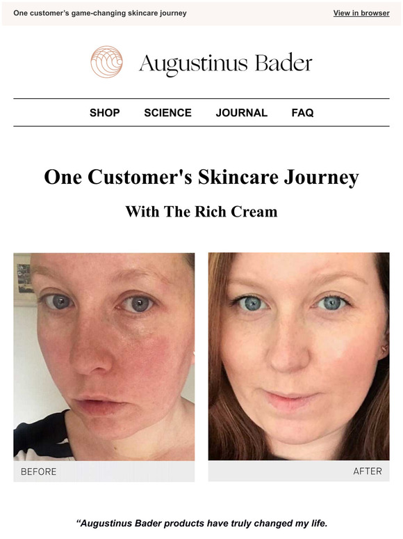 Augustinus Bader: "Augustinus Bader products have truly changed my life ...