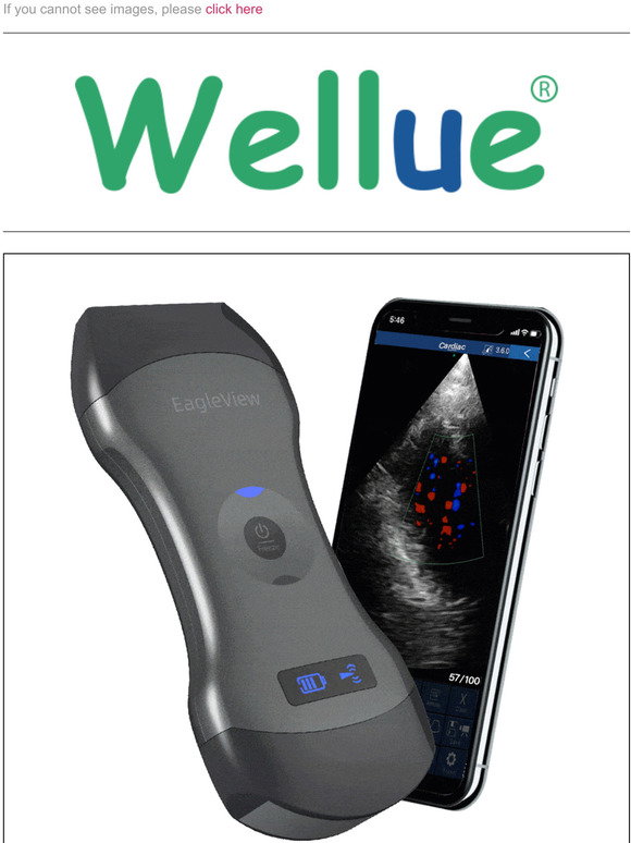 Viatom Technology Co., Ltd.: All questions about Eagleview Ultrasound ...