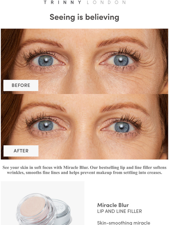 Trinny London: Everyones favourite wrinkle filler | Milled