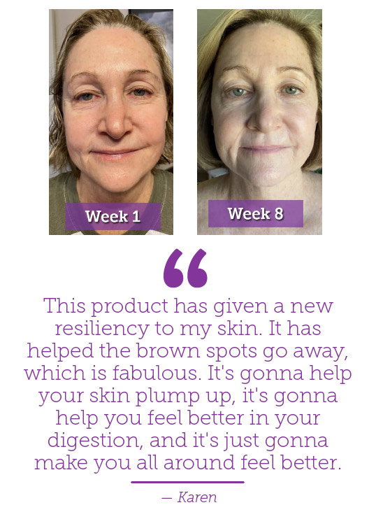 Dr. Kellyann: NEW from Dr. Kellyann: BellaBiotics | Milled