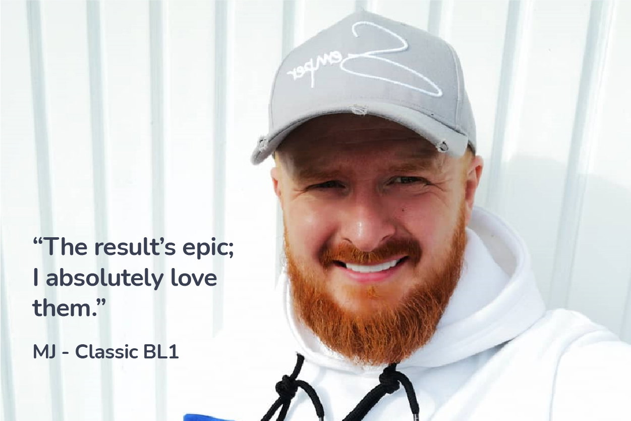 INSTAsmile: -instasmile is a revolution in Smile Design | Milled