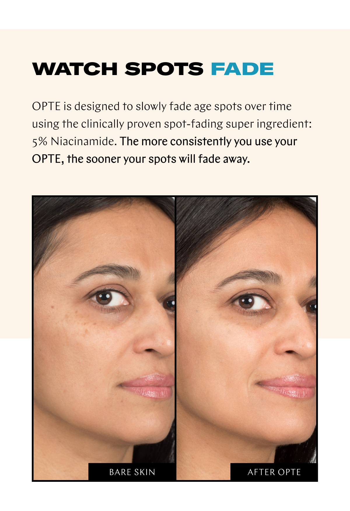 OPTE Skin: The secret to fading hyperpigmentation | Milled