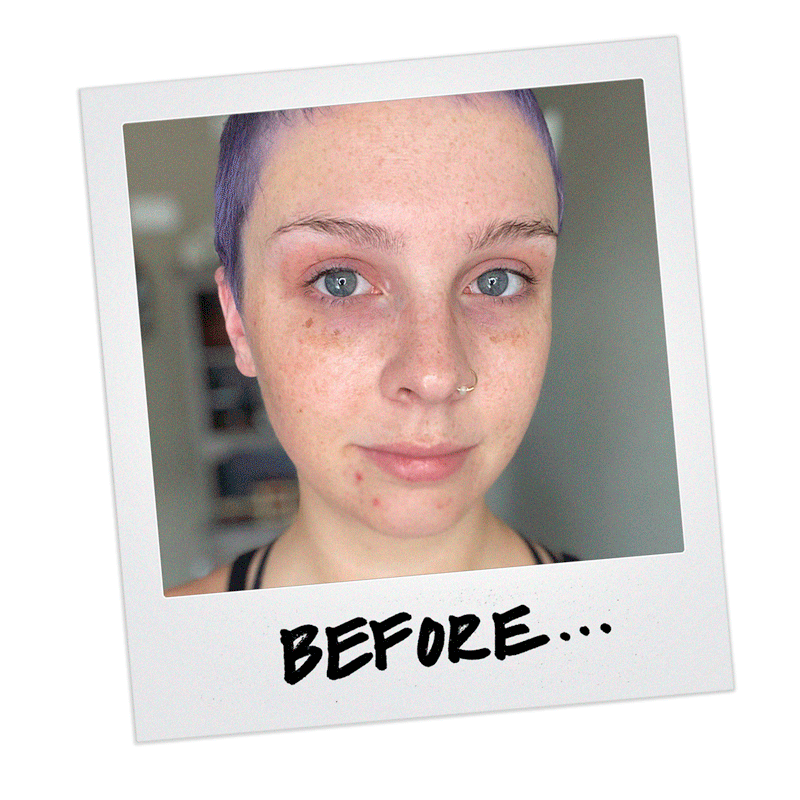 Hero Cosmetics: What really causes the dark spots on my face? | Milled