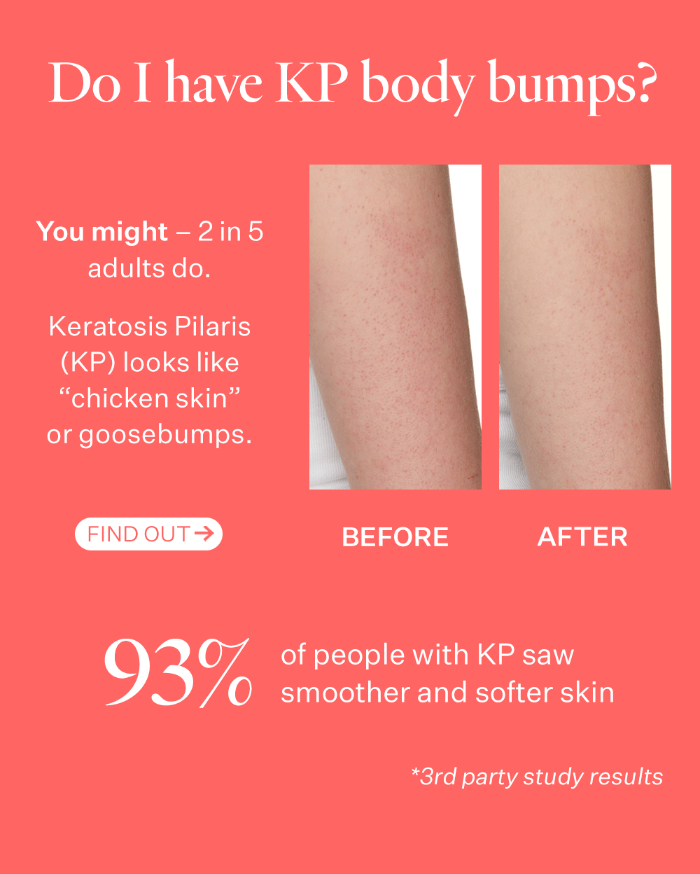 Peach and Lily: NEW KP Bump Boss (limited # left!) | Milled