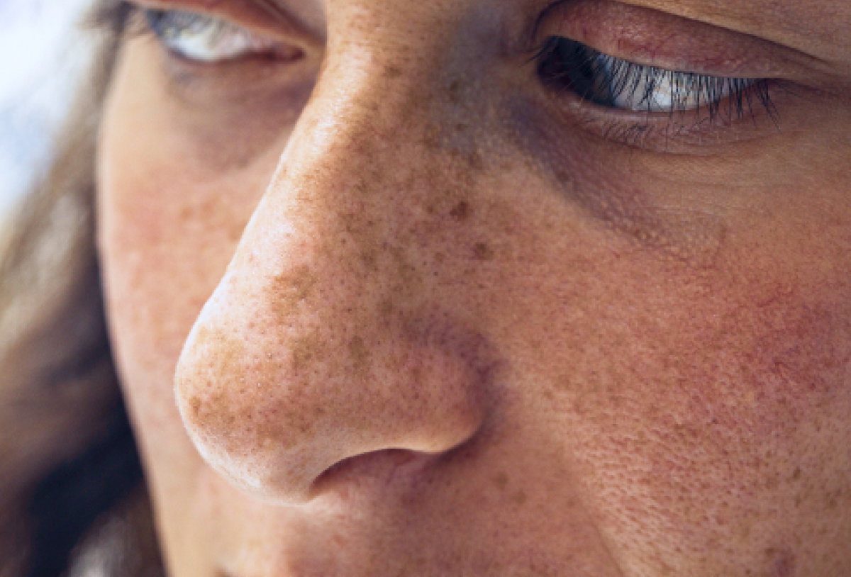 Musely: Are sunspots permanent? | Milled