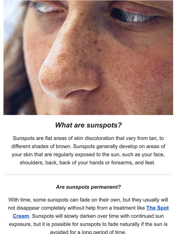 Musely: Are sunspots permanent? | Milled