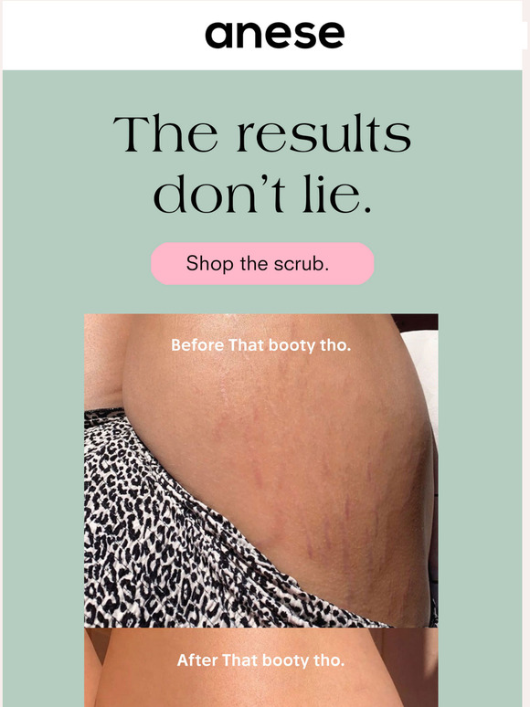 Anese: This is impressive... | Milled