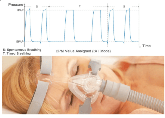 Wellue: Alternative to CPAP machine | Milled