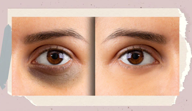 Swiss Botany: ALL Under Eye Skin Problems Solved! | Milled