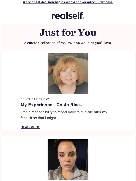 RealSelf: See real-life Facelift results | Milled