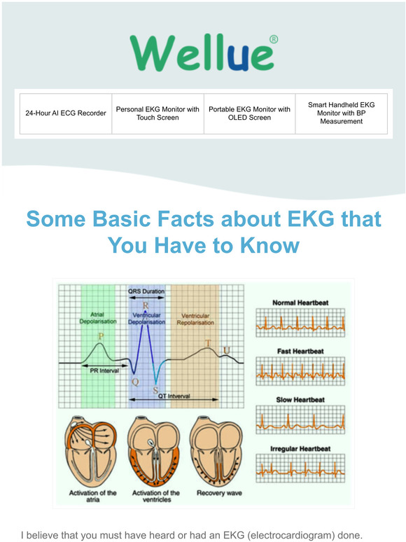 Wellue: Some Basic Facts about EKG that You Have to Know | Milled