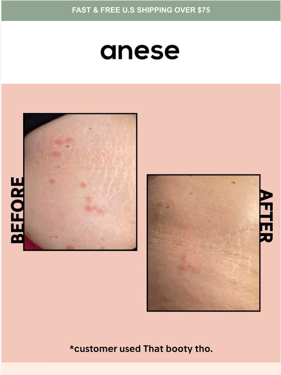 Anese: "Holy crap, I didn't realize how drastically these products have ...