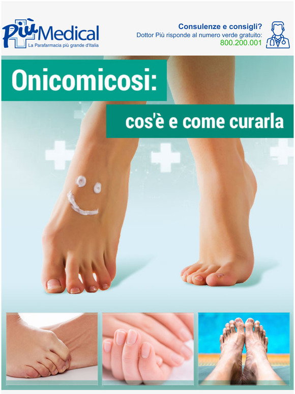 Più Medical: Onicomicosi? Conoscerla il primo passo per trattarla! | Milled