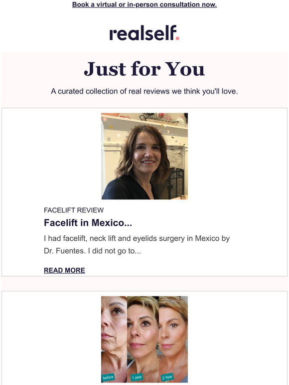 RealSelf: The Facelift experience, according to real patients | Milled