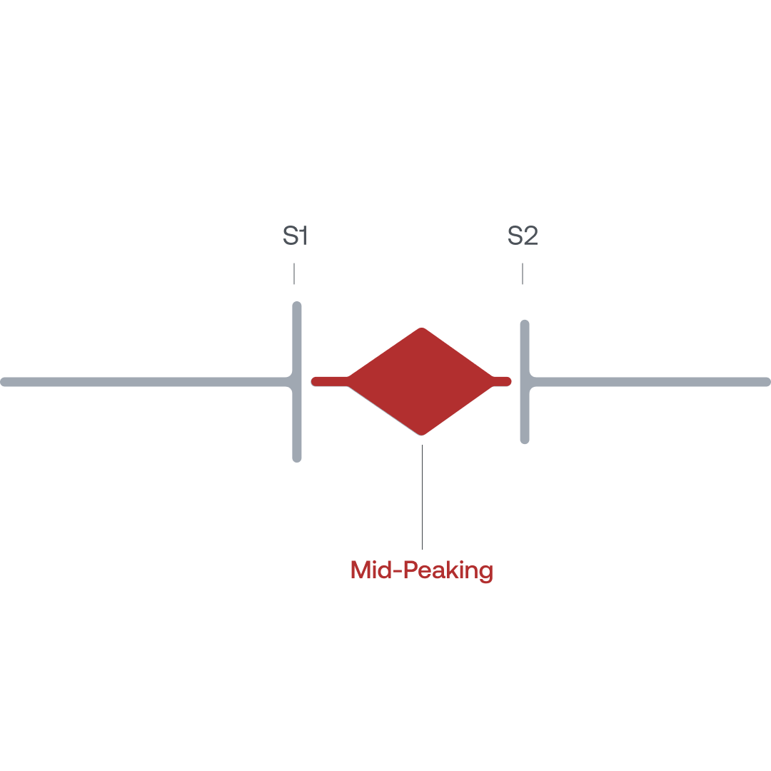 Eko: Understanding Murmur Timing (Part 1) | Milled