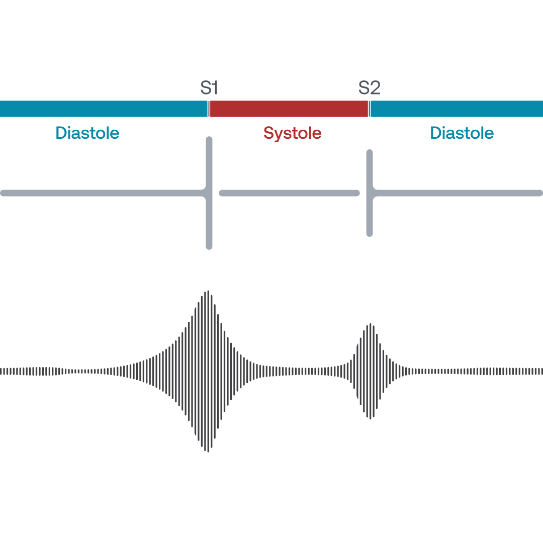 Eko: Understanding Murmur Timing (Part 1) | Milled