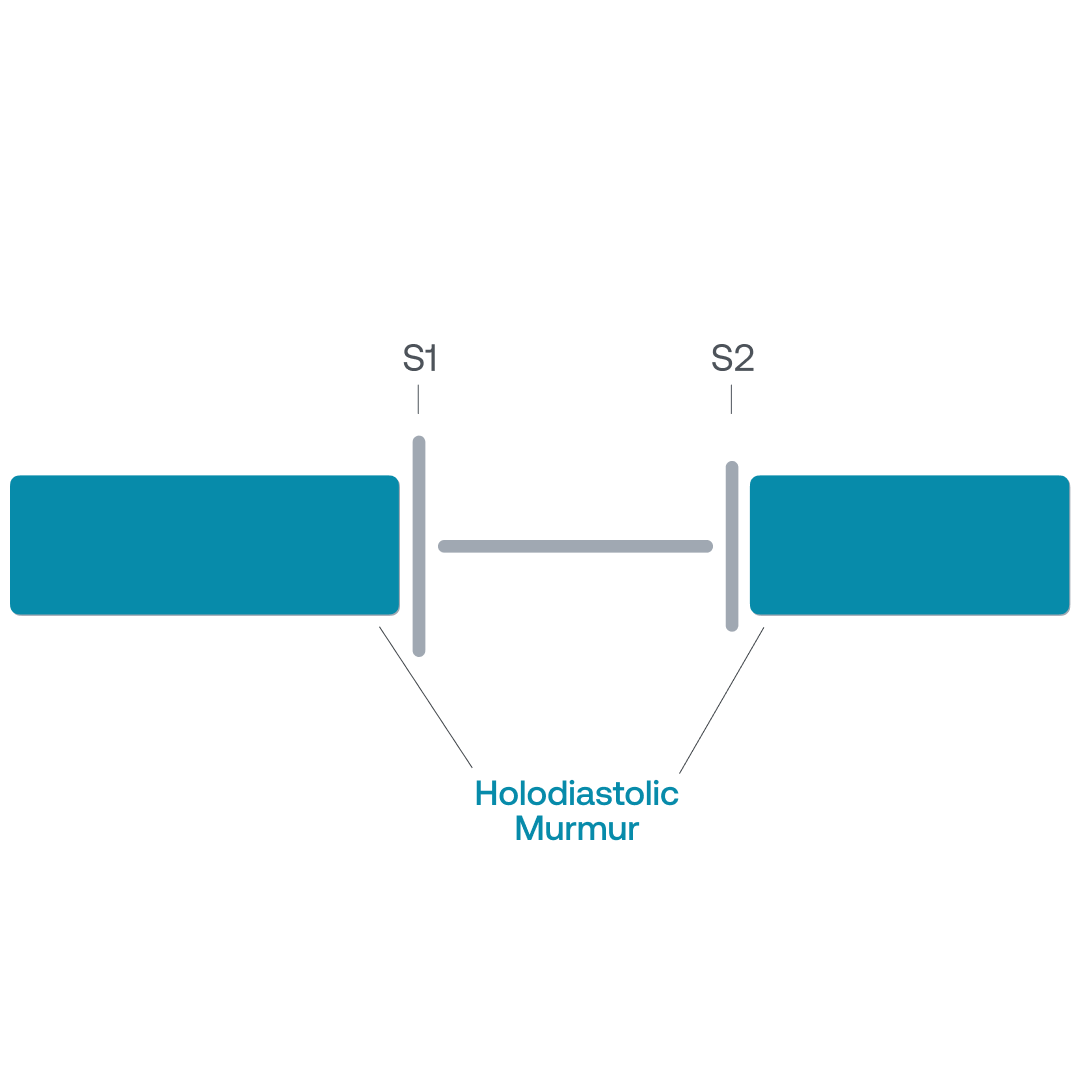Eko: Understanding Murmur Timing (Part 2) | Milled