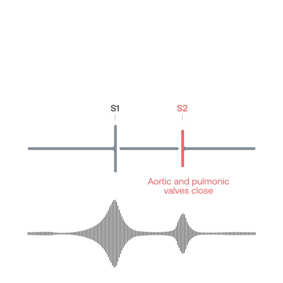 Eko: Understanding Heart Sounds (Part 1) | Milled