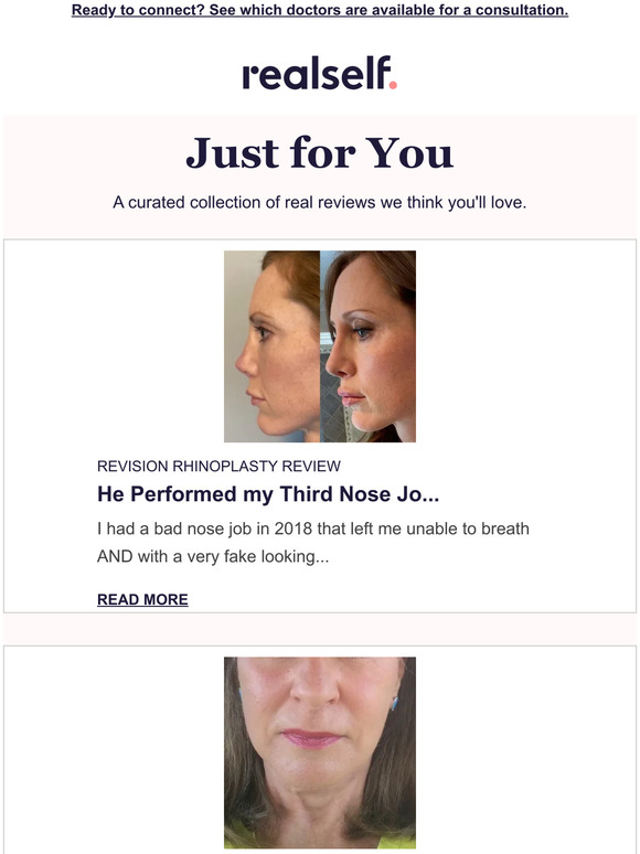 Realself Considering Revision Rhinoplasty Read This First Milled