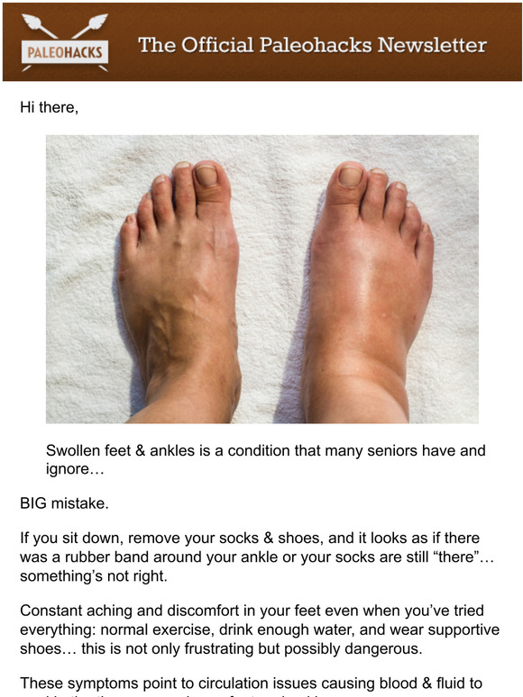PaleoPlan: Ankles swelling up like balloons | Milled