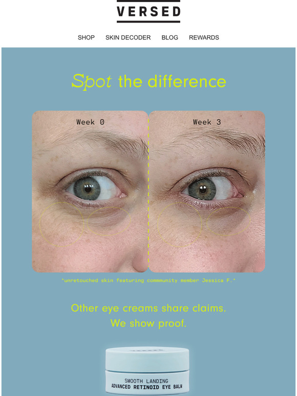 Versed: The proof is in the before and after photos | Milled