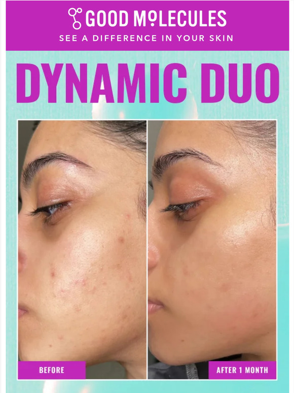 Good Molecules: how to fade blemish scars in a month ⚡ | Milled