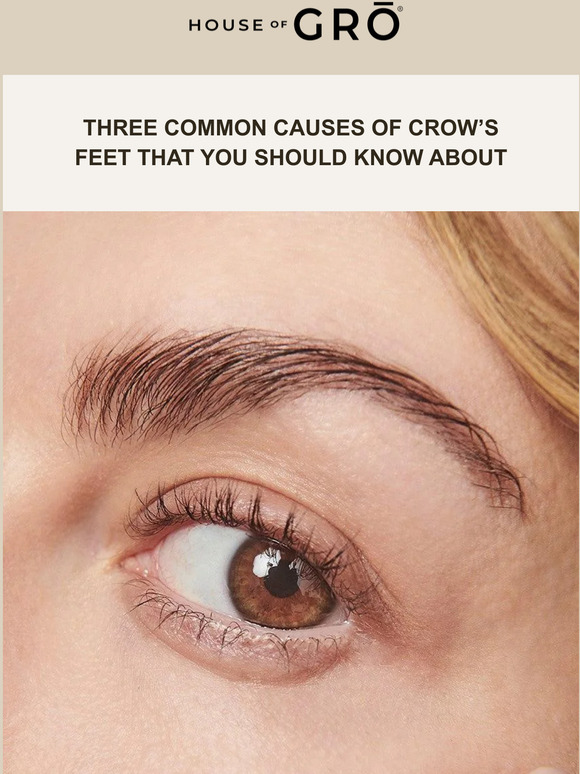 House of Gro: THREE COMMON CAUSES OF CROW’S FEET THAT YOU SHOULD KNOW ...
