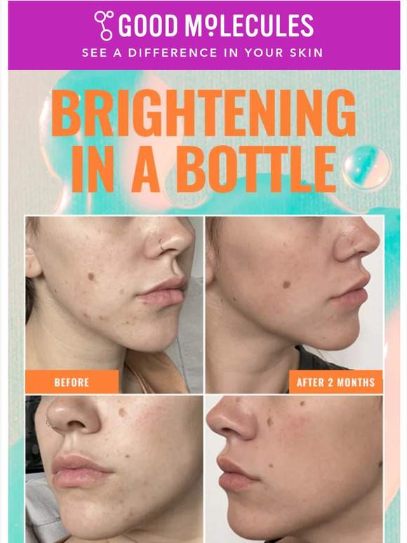 Good Molecules: how to even out skin tone? 🌟 | Milled