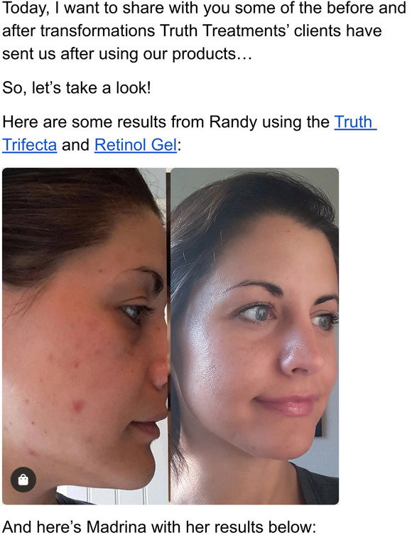 Truth Treatments: Before and after transformations | Milled