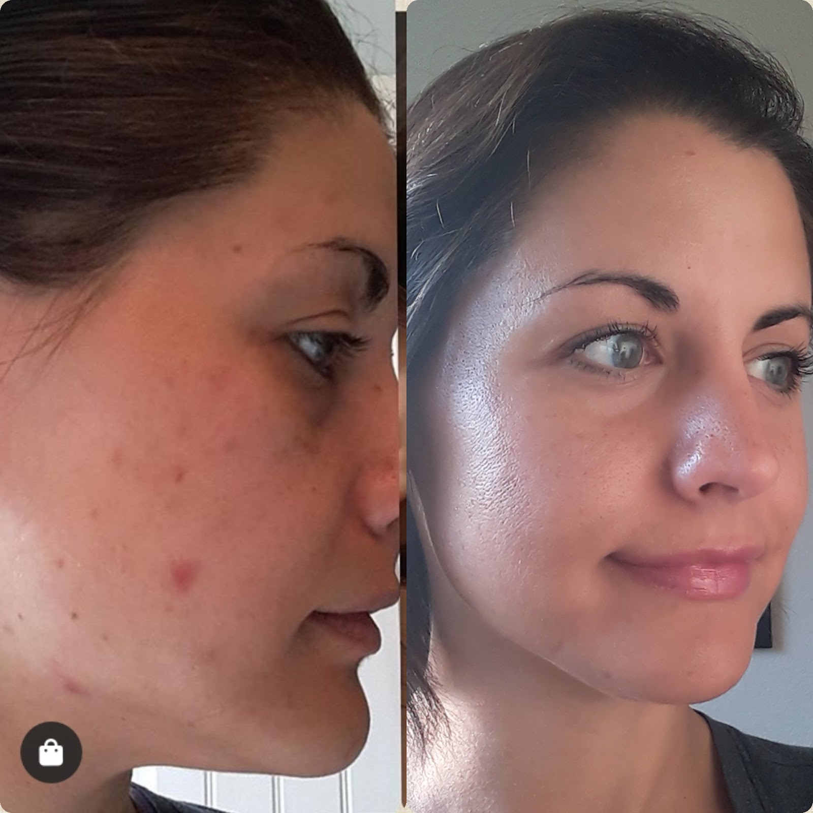 Truth Treatments: Before and after transformations | Milled