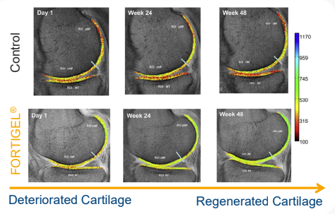 Healthy Back Institute: Regenerate Cartilage in Seconds | Milled