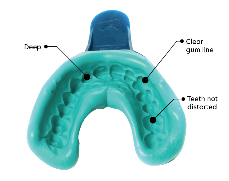 INSTAsmile: The perfect instasmile starts with a great first impression ...