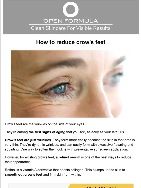 Open Formula: How to reduce crow’s feet | Milled