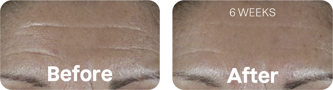 ATTITUDE: 70% say it evened out their skin tone | Milled