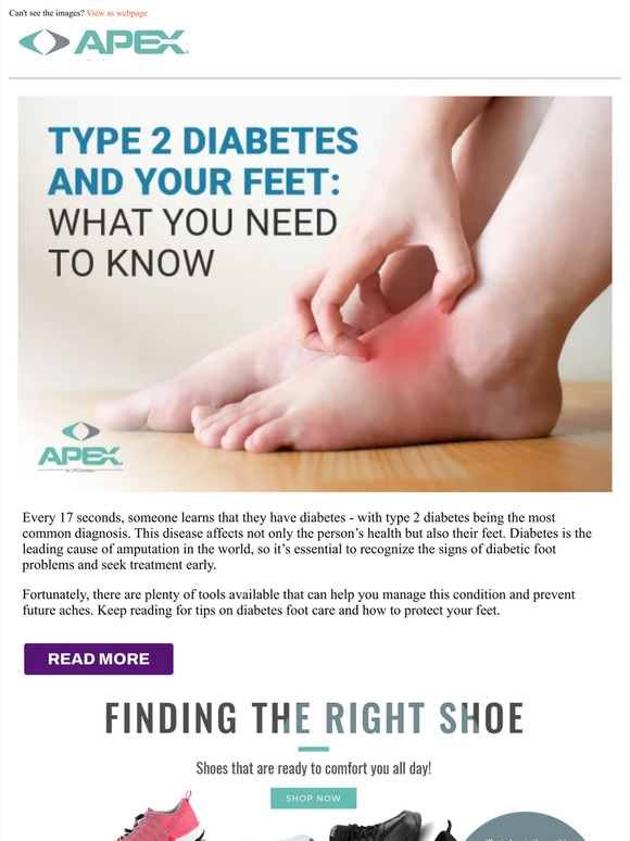 Apex Foot: Type 2 Diabetes and Your Feet: What You Need to Know | Milled