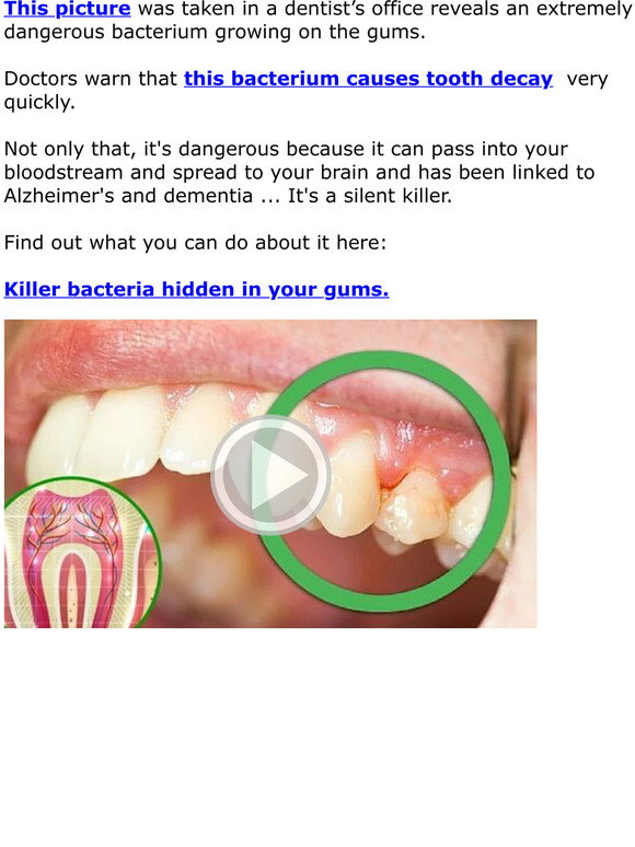 DeRose Health: Damaged Gums? This Life-Threatening Bacteria Eats Your ...