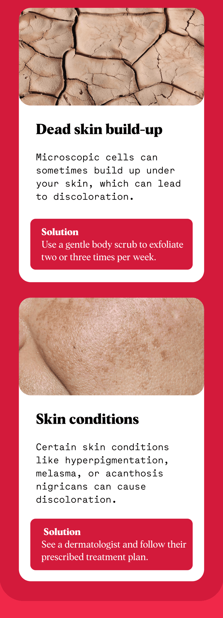 Duradry 3 Causes Of Dark Armpits And What You Can Do About It Milled
