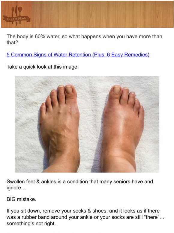 PaleoPlan: 5 Common Signs of Water Retention (plus an easy remedy) | Milled
