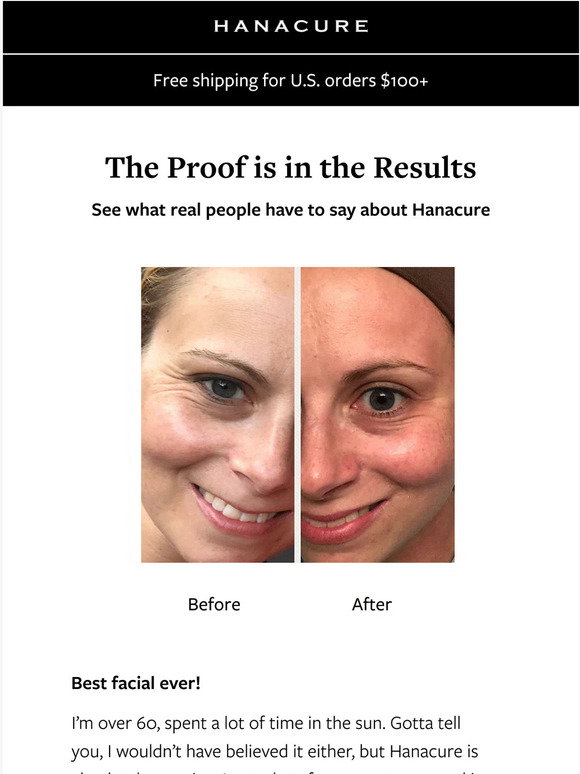 Hanacure: Real Results. Real People. | Milled
