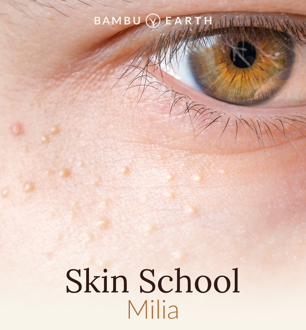 Bambu Earth: Skin School: Milia | Milled