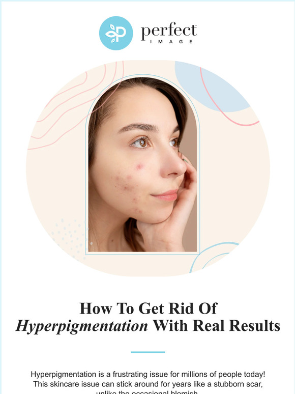 Perfect Image: How to get rid of hyperpigmentation with real results ...