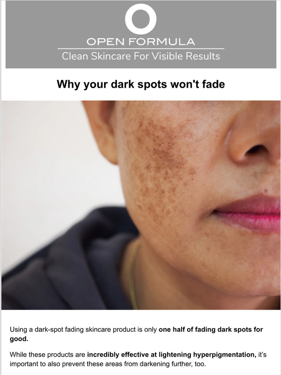 Open Formula: Why your dark spots won’t fade | Milled