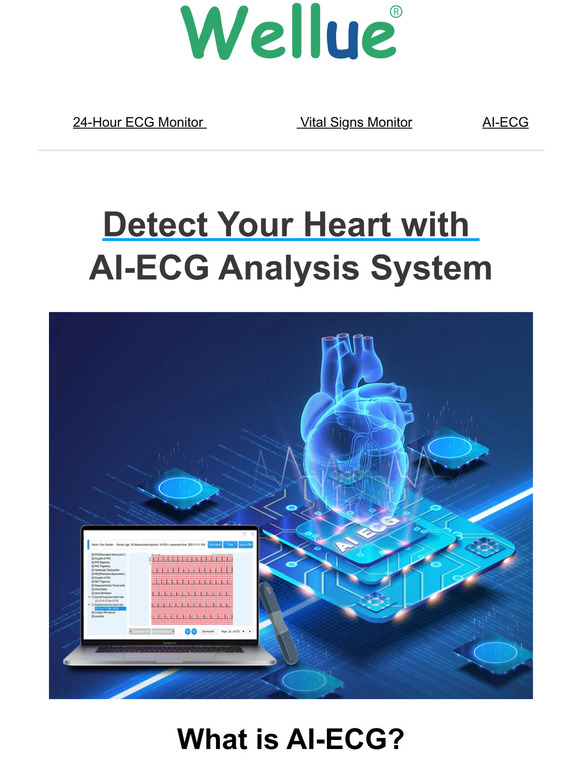 Wellue: Detect Your Heart with AI-ECG Analysis System | Milled