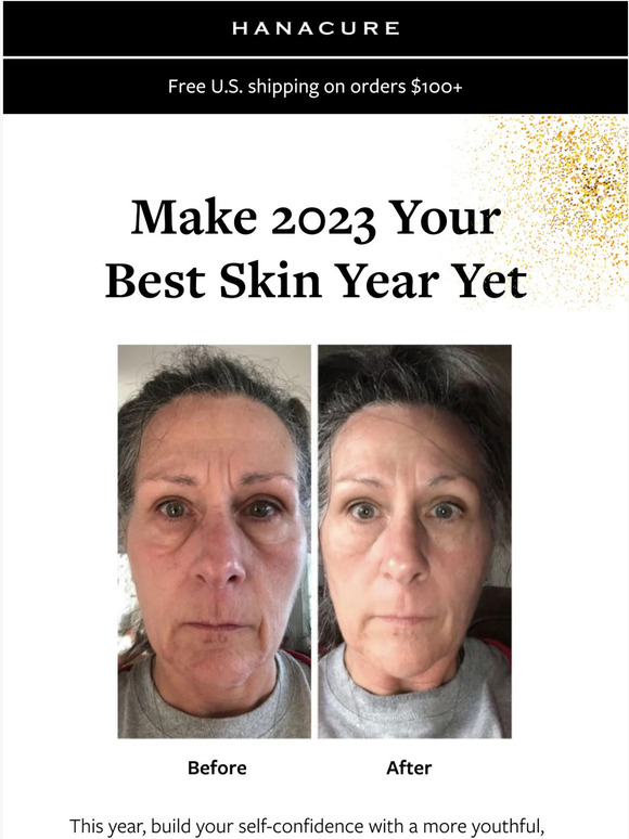 Hanacure: You Won’t Believe this Before and After 😍 | Milled