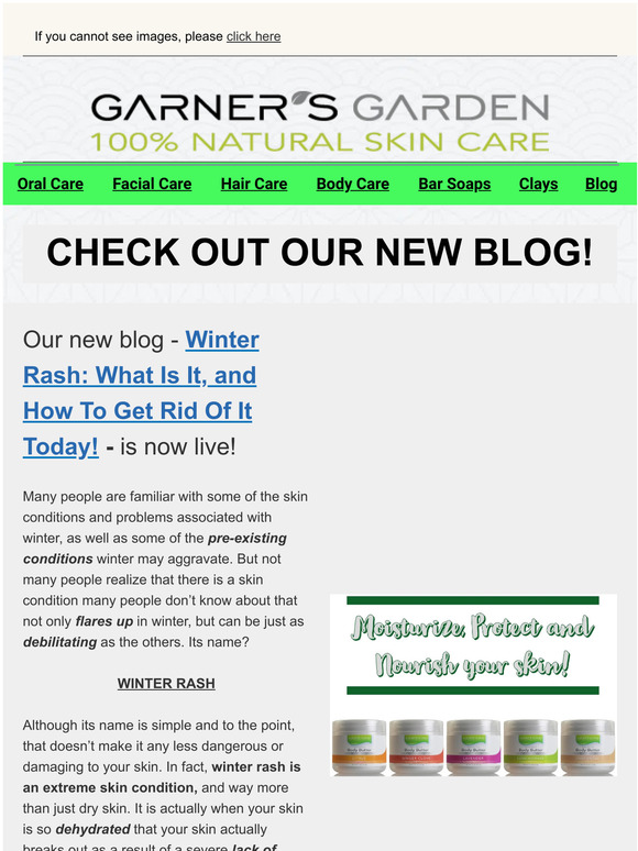 Garner's Garden: 💦 Winter Rash: What Is It, and How To get Rid Of It ...