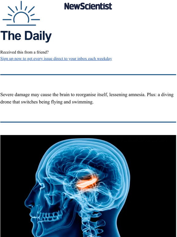 new-scientist-mild-brain-damage-may-affect-memory-more-than-severe